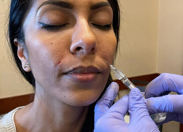 Dermal Filler Training for Physicians (MD/DO) | CME Certification ...